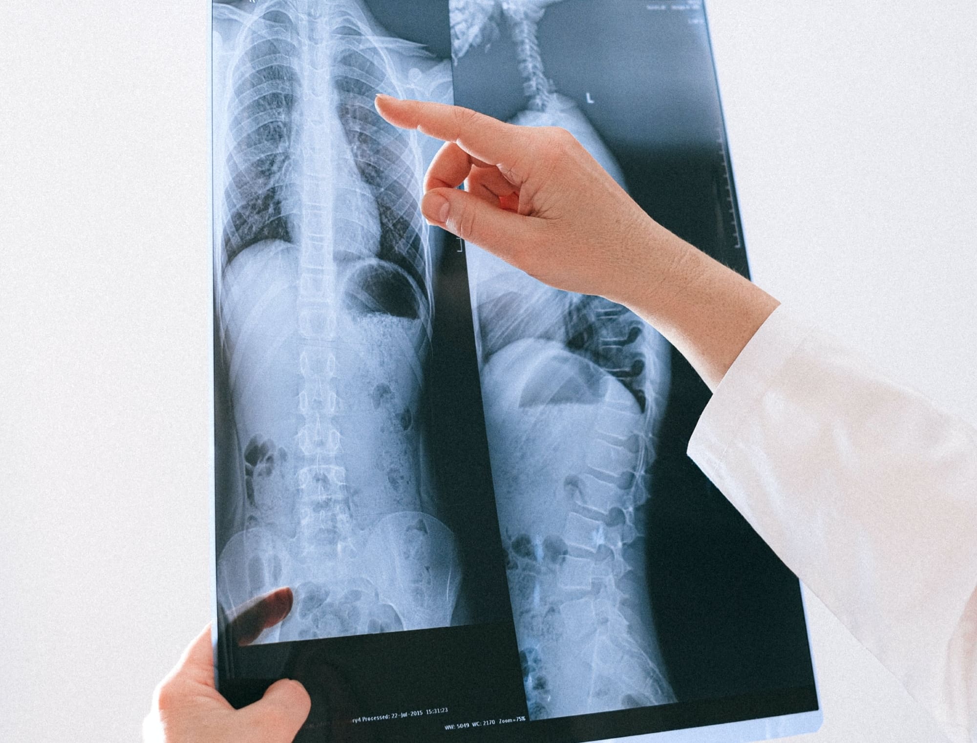 Dijagnostika Centar - Rendgen