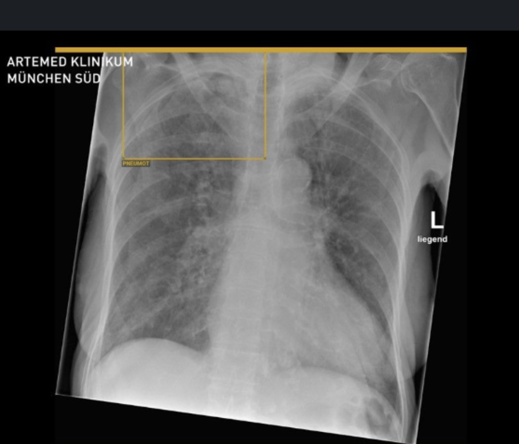 deepc blog: Artificial Intelligence for Chest X-Ray Transforming ...