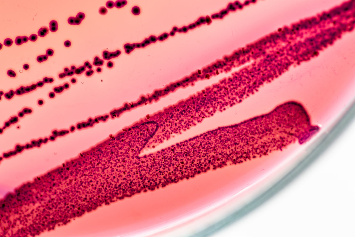 Background | SNAP Trial – Staphylococcus aureus Network Adaptive ...