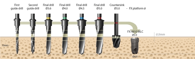 Implantium Implants