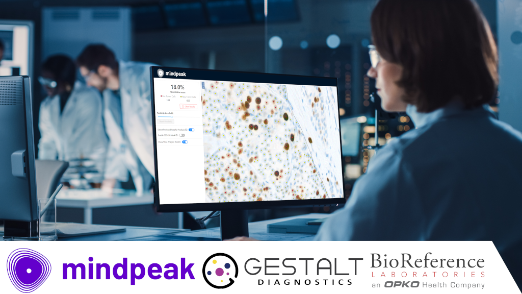 Mindpeak News | First Deep Learning AI in Clinical Routine in US!