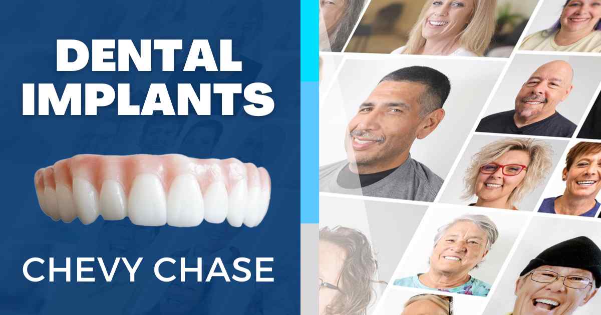 24 Hour Dental Implants Chevy Chase, MD | Nuvia Dental Implant Center