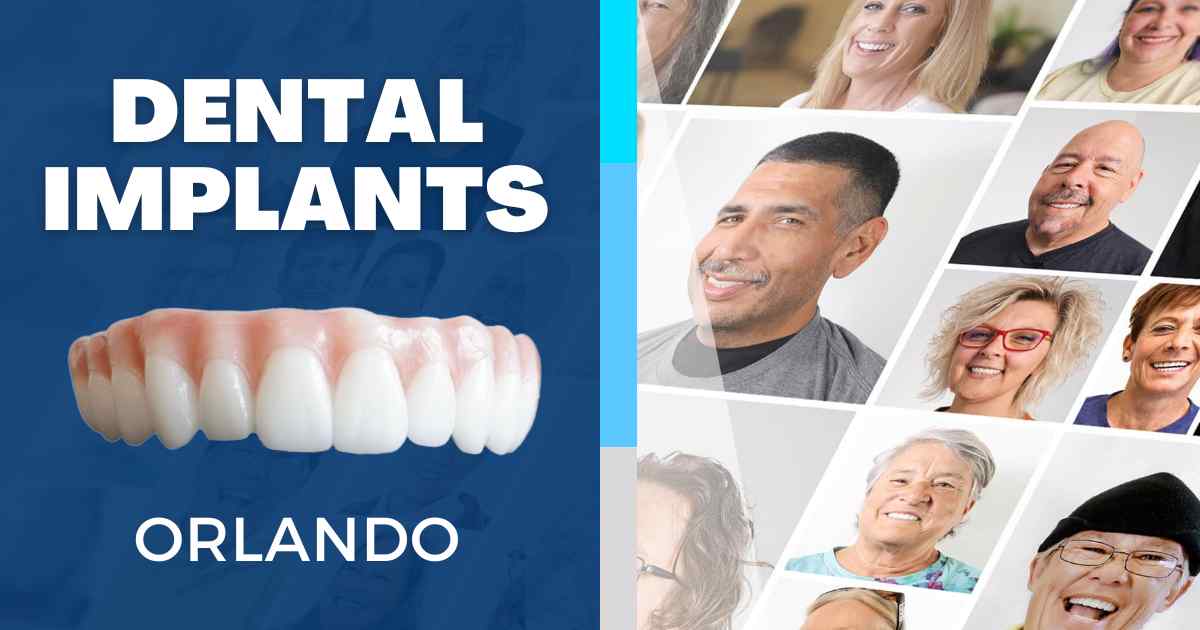 24 Hour Dental Implants Orlando FL | Nuvia Dental Implant Center