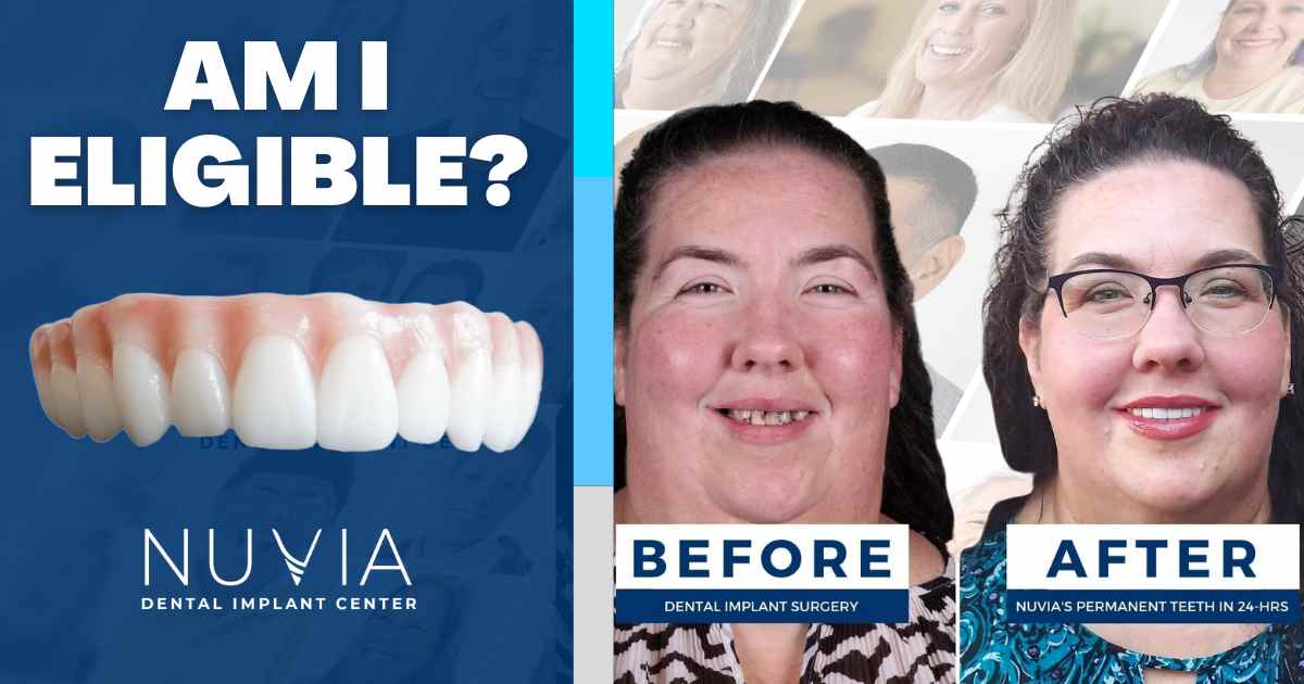 Am I Eligible For Dental Implants? | Nuvia Dental Implant Center