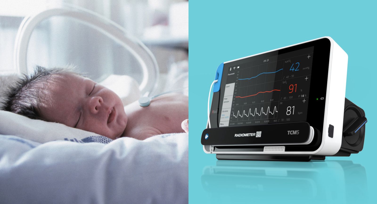 TCM5 Flex for Radiometer — FLUID Design