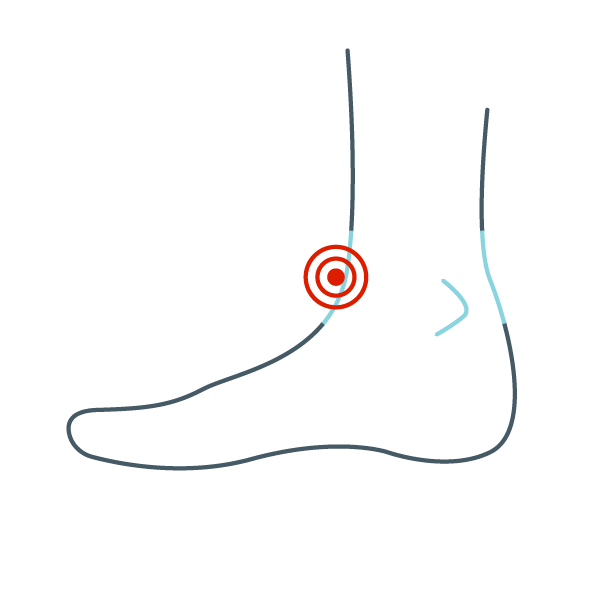 Ankle Sprain Pain & Injuries | The Sports Injury Clinic