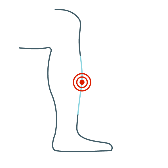 Cartilage Injury of the Knee Pain & Injuries | The Sports Injury Clinic