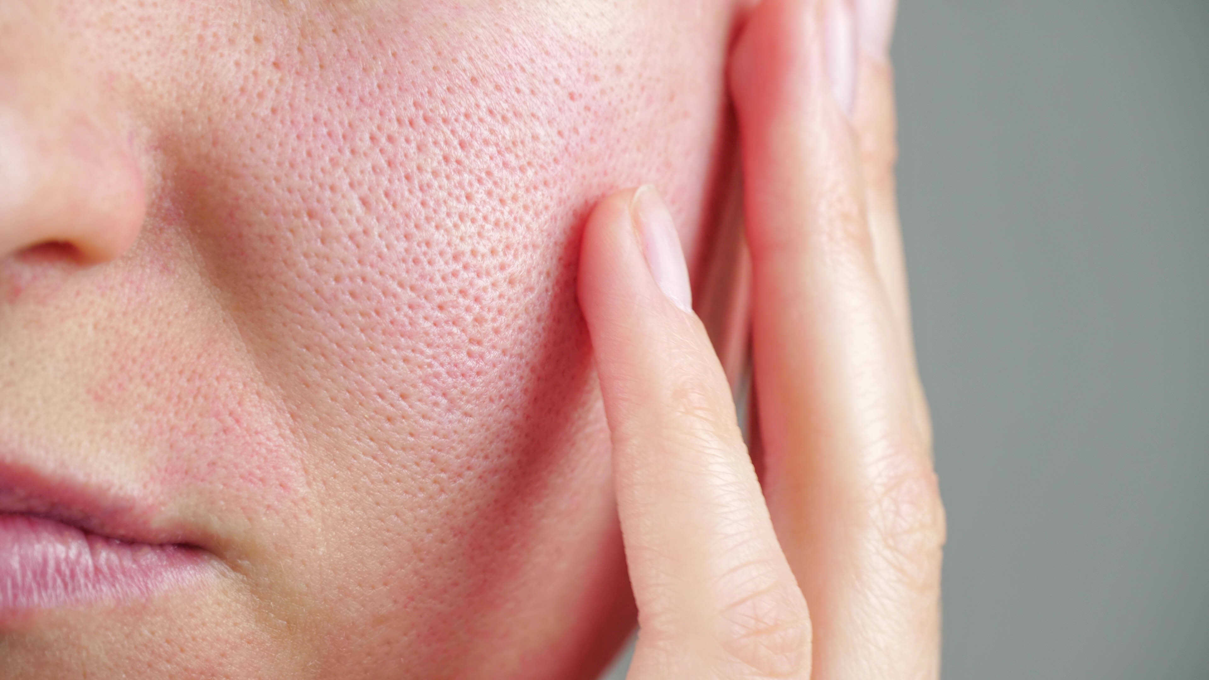 Everything you Need to Know About Pores and Pore Size | ZONA Med Spa