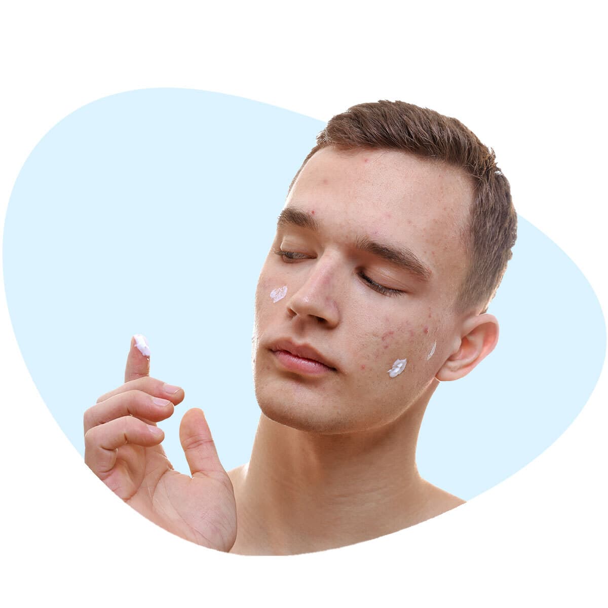 Acnelogy | Tratamientos personalizados para tu piel