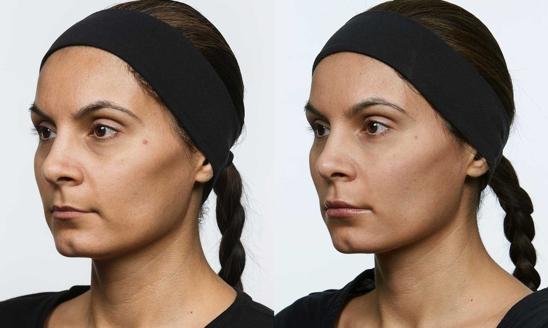 Cosmetic, Medical And Surgical Dermatology Clinic | Dermetics