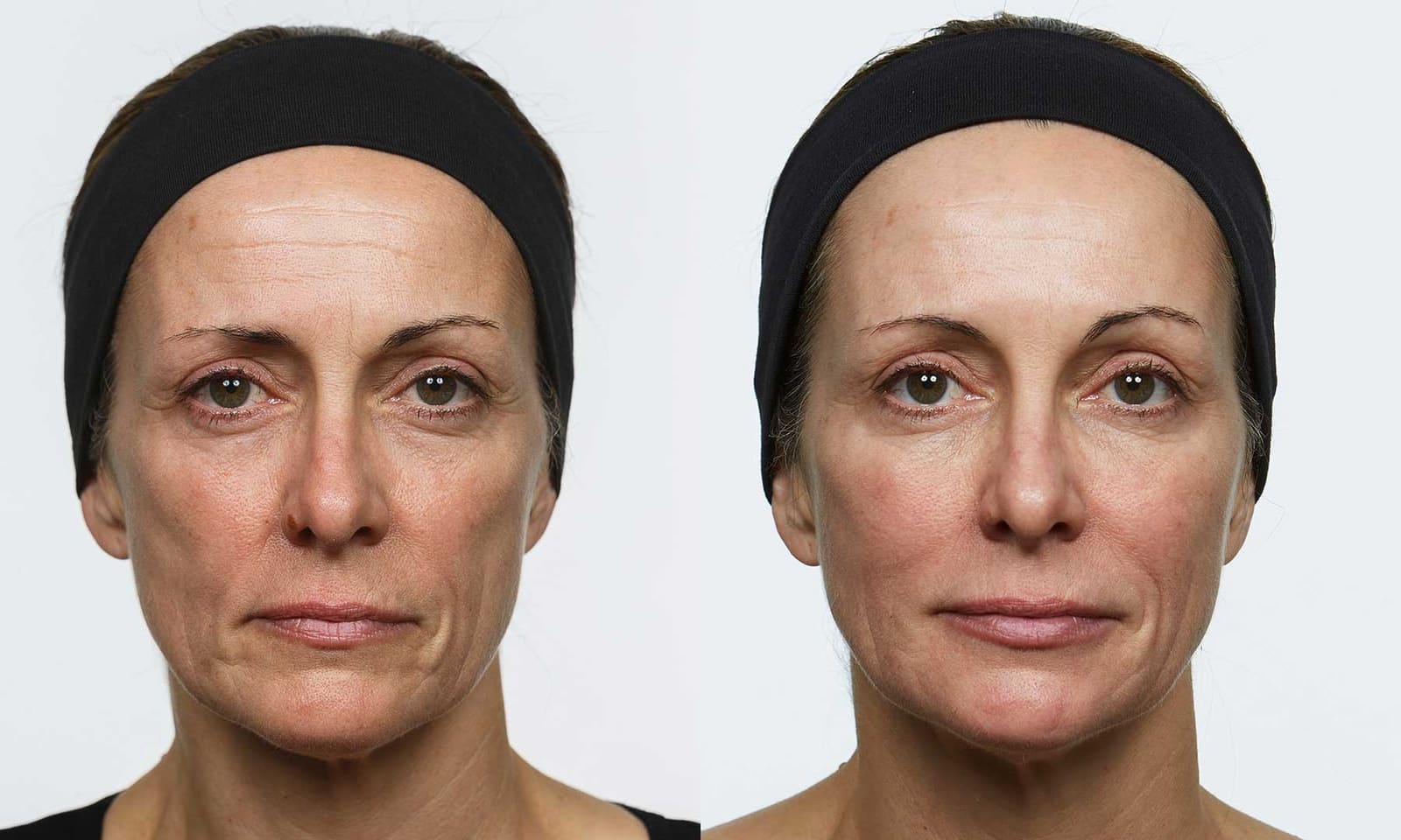 Cosmetic, Medical And Surgical Dermatology Clinic | Dermetics