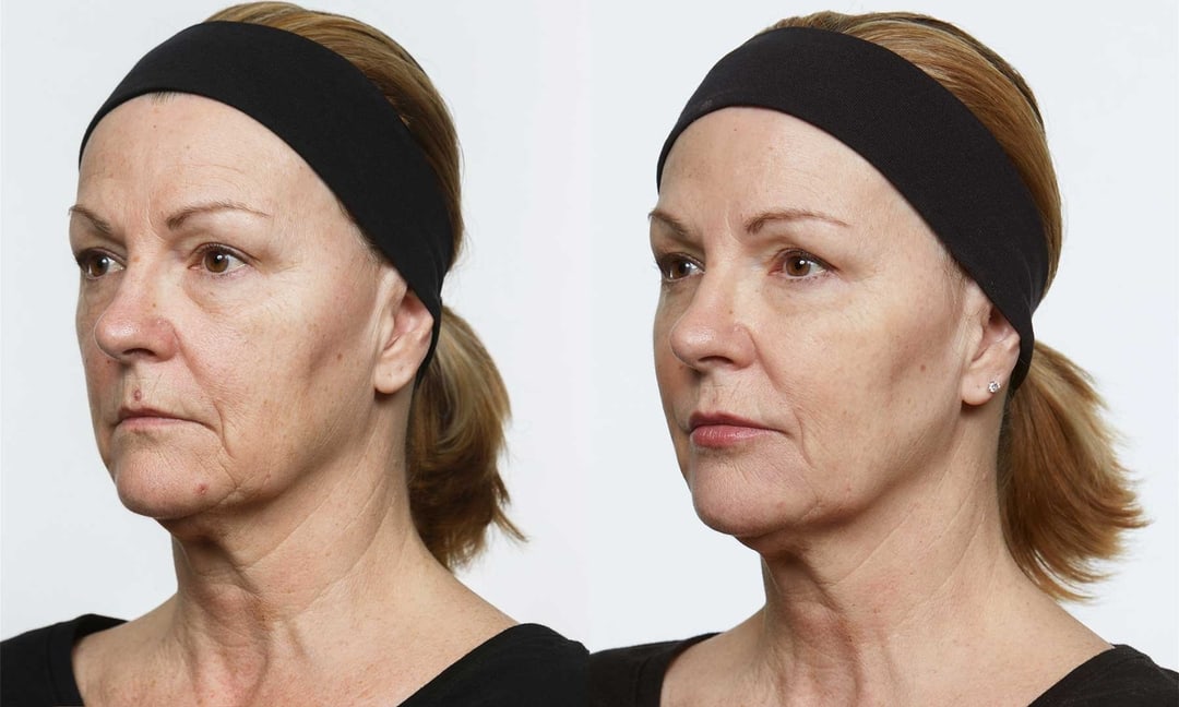 Cosmetic, Medical And Surgical Dermatology Clinic | Dermetics