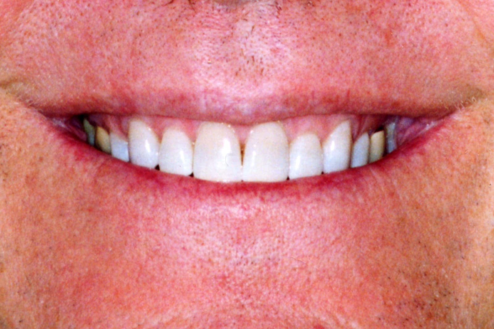 Dental Care Services by Walker Dental Group in Macon, GA