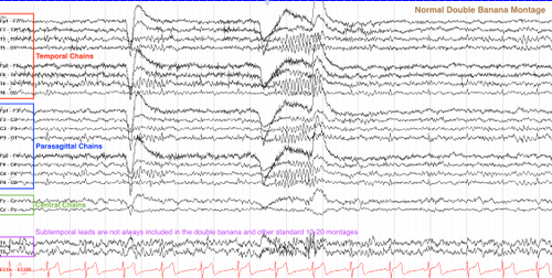 Learning EEG