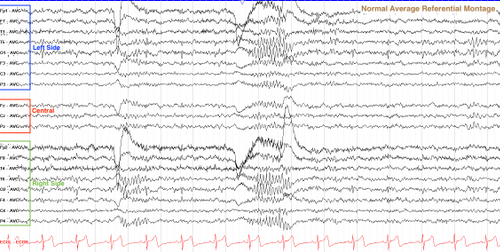 Learning EEG