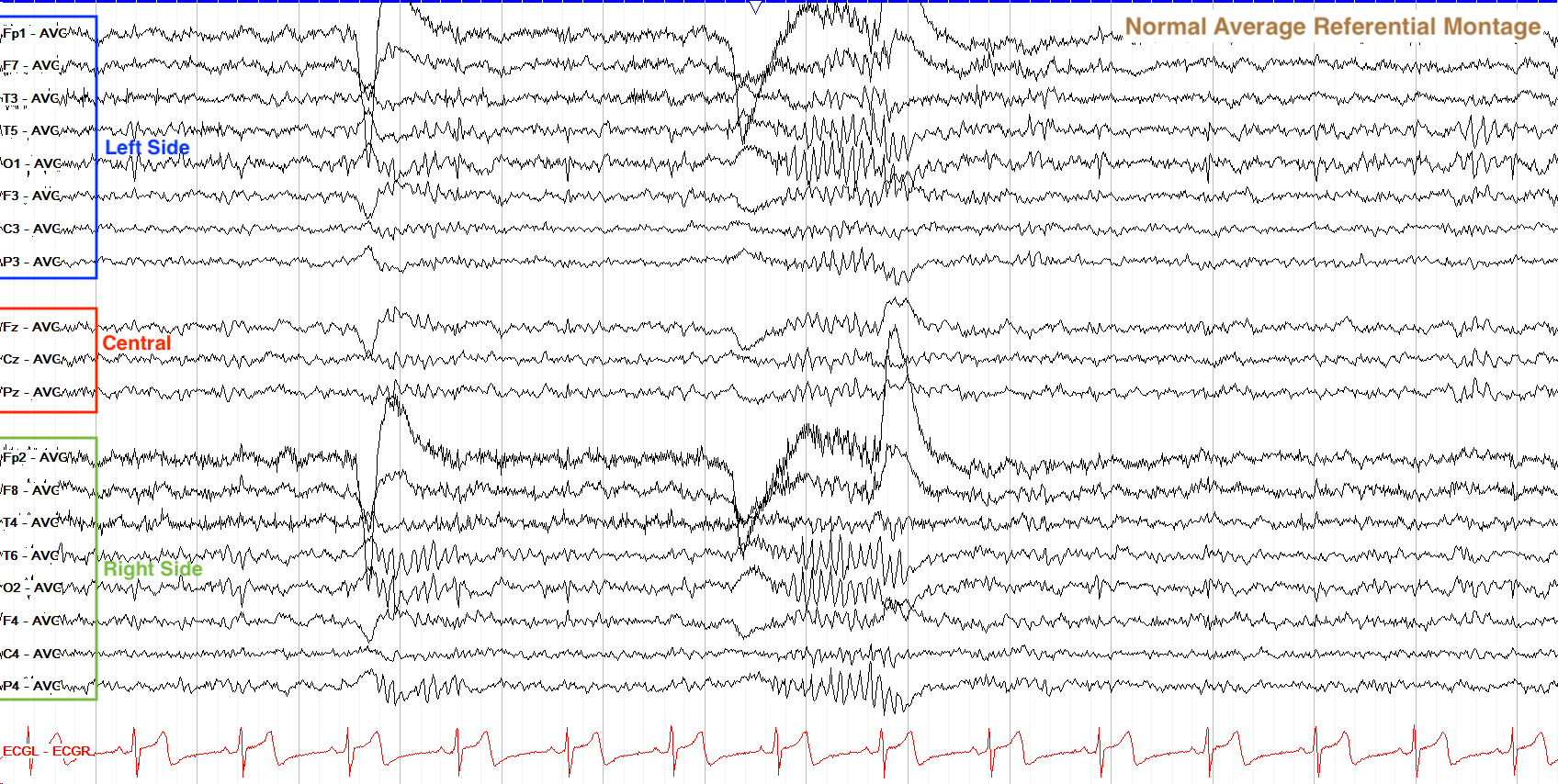 Learning EEG