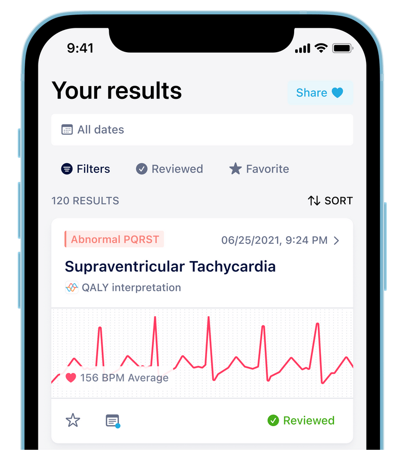 QALY | What Heart Palpitations and Ectopic Beats Look Like on Your ...