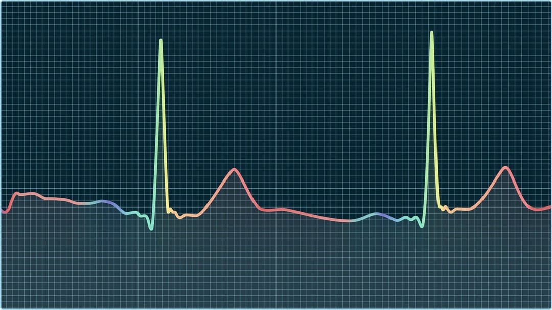 QALY | How to Measure PR, QRS, and QTc Intervals from Your Watch ECG