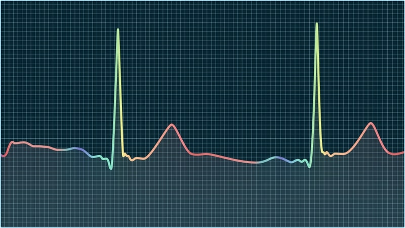 QALY | How to Measure PR, QRS, and QTc Intervals from Your Watch ECG