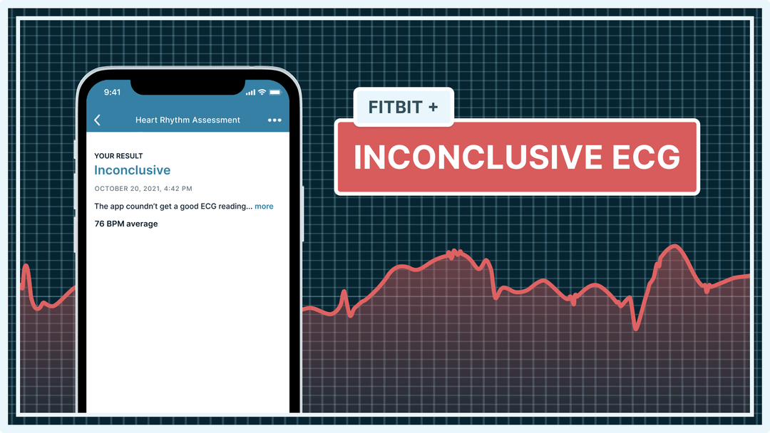 QALY | What Inconclusive Means on Your Fitbit ECG