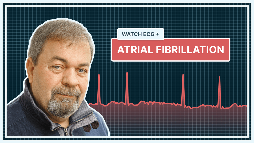 QALY | What Atrial Fibrillation (Afib) Looks Like on Your Watch ECG