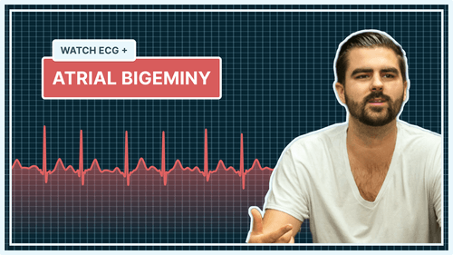 QALY | What Atrial Bigeminy Looks Like on Your Watch ECG