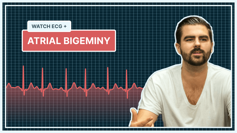 QALY | What Atrial Bigeminy Looks Like on Your Watch ECG