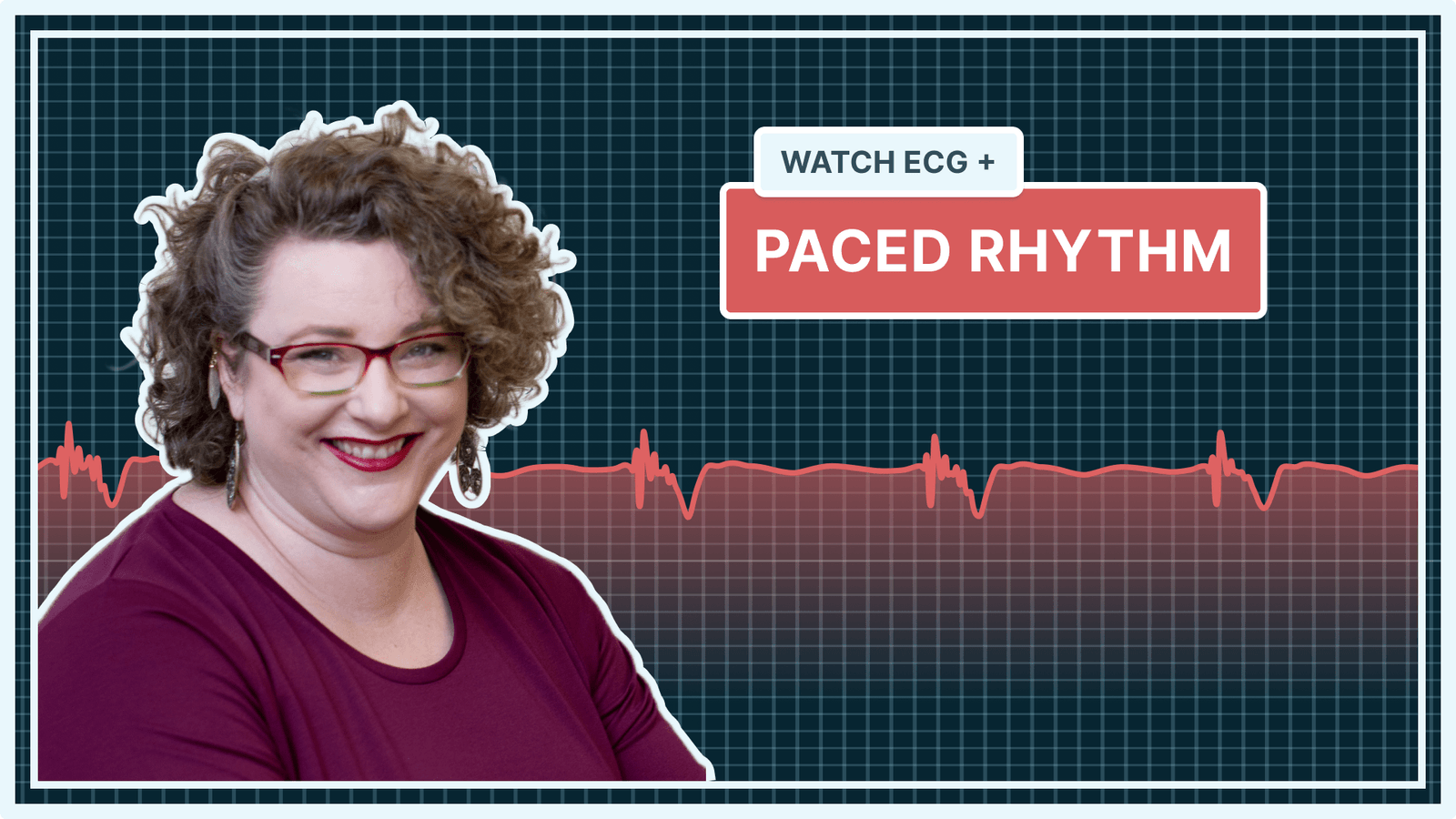 QALY | What Paced Rhythm Looks Like on Your Watch ECG