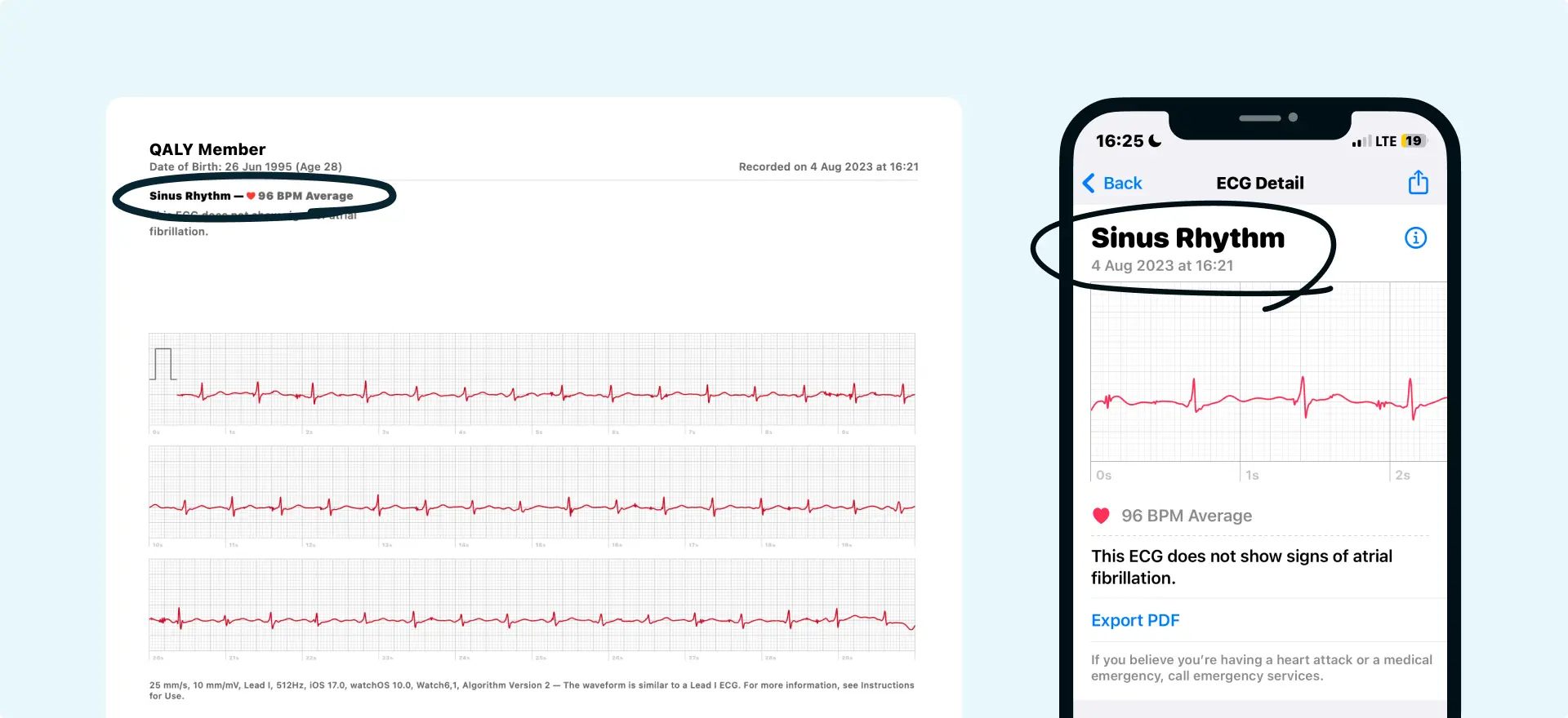 How to Install the ECG App on Your Apple Watch | Qaly