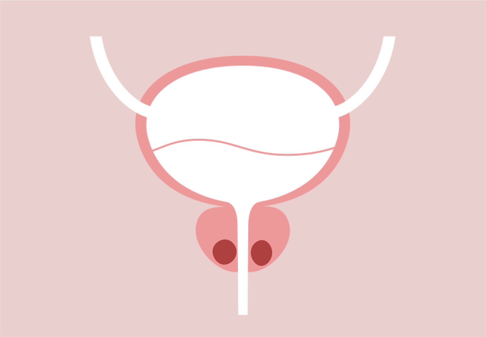 Das Wichtigste über Prostatakrebs | Uroletics