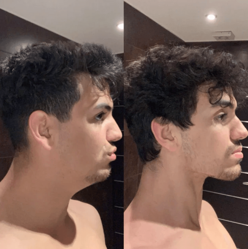 Ask Your Question About Mewing