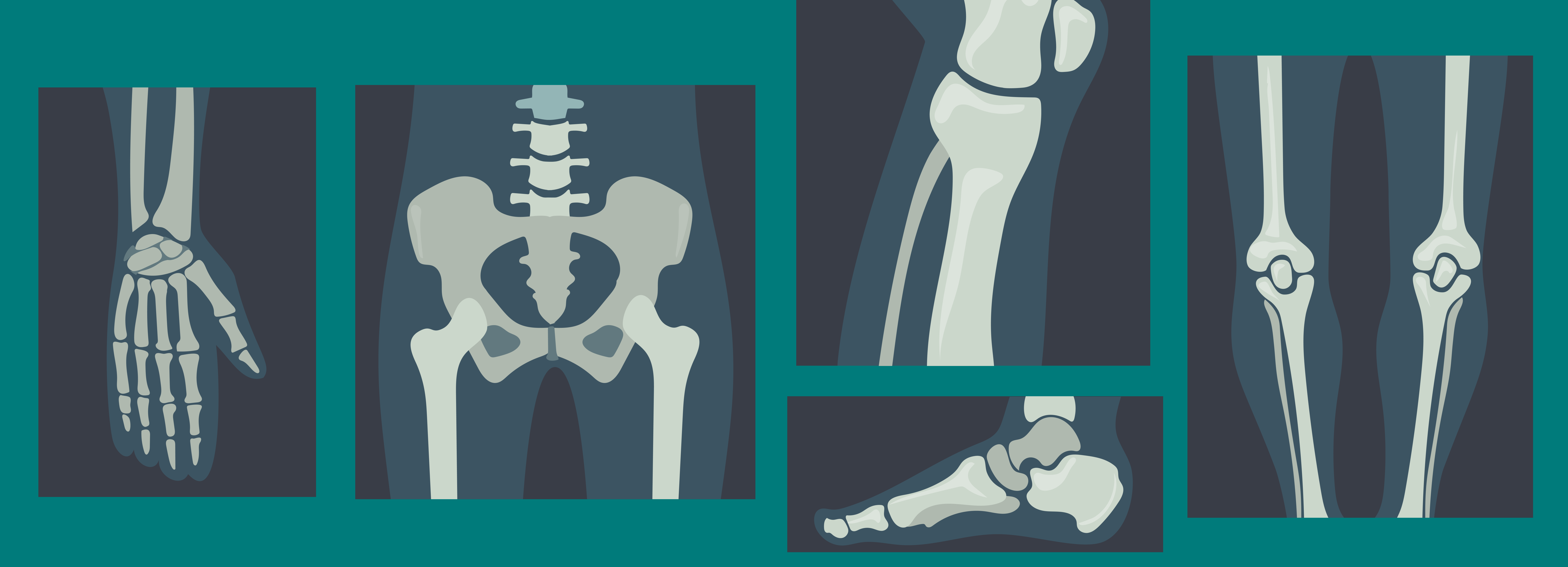 Bone Health