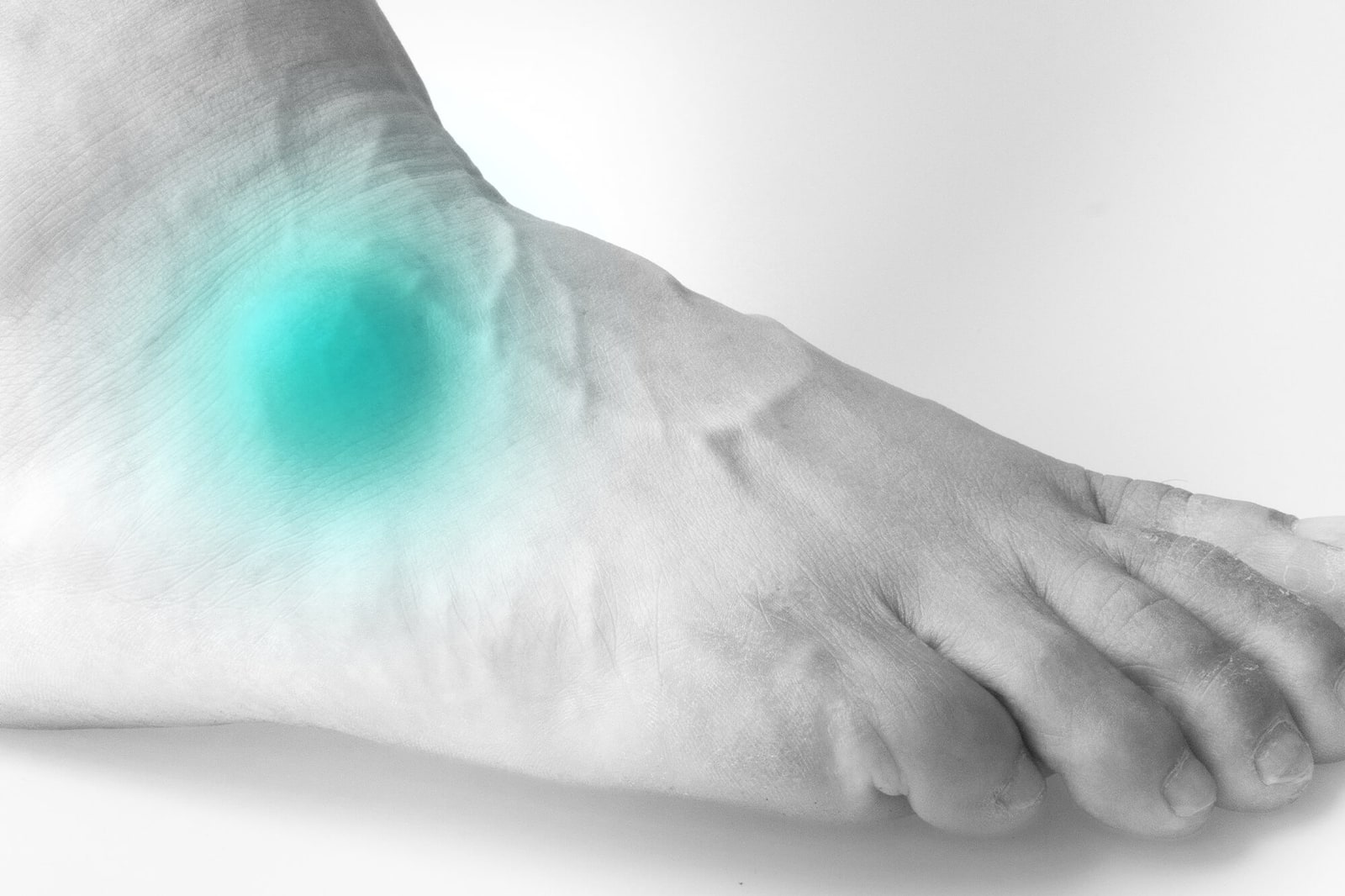 Mucoid Cyst | Mississauga Foot Clinic