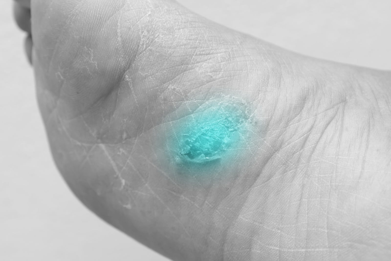 Foot Issues | Mississauga Foot Clinic