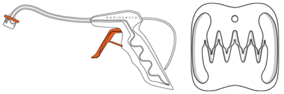 OTSC® Proctology System | Gastroenterology