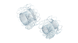 Pseudo Cyst Stent | Gastroenterology