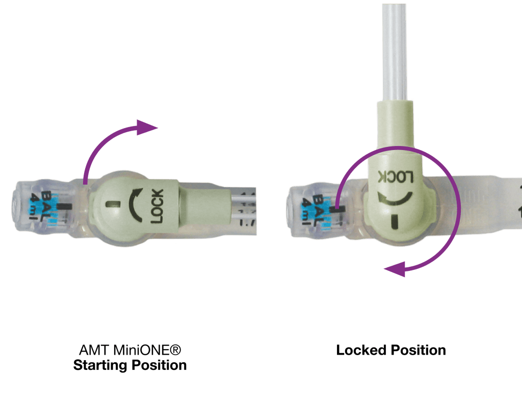 MiniONE® | Enteral Feeding