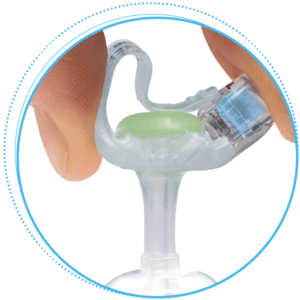 MiniONE® Balloon Button | Enteral Feeding