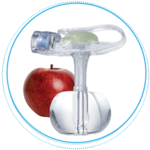 MiniONE® Balloon Button | Enteral Feeding