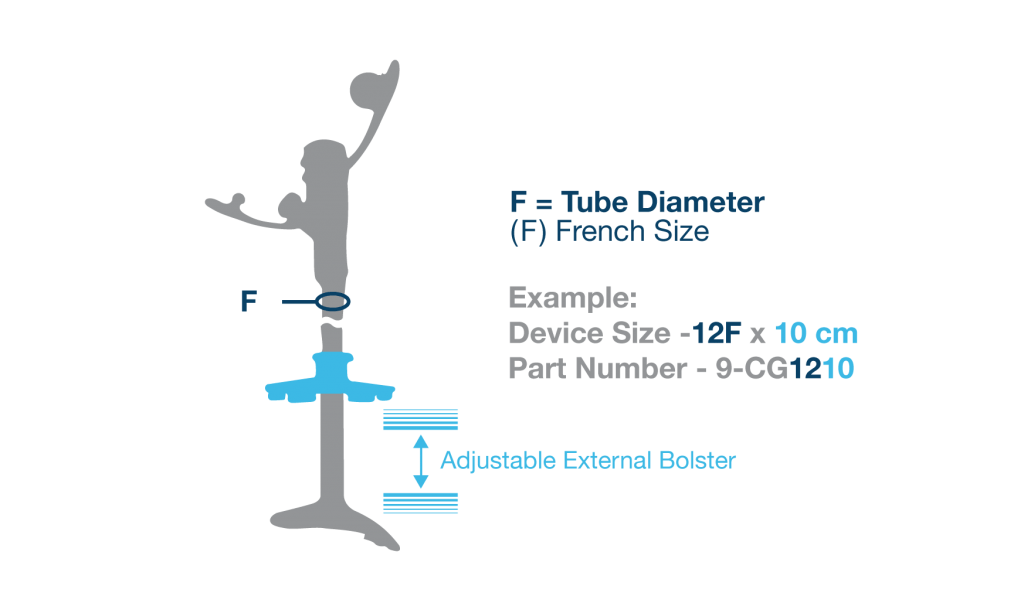 Capsule Monarch® G-Tube | Enteral Feeding