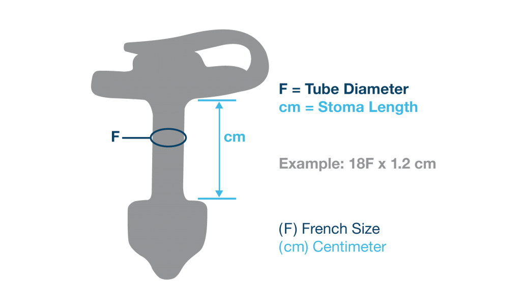 MiniONE® Classic Low Profile Button G-Tube | Enteral Feeding