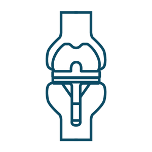 Klassic® Knee System | TJO - Total Joint Orthopedics