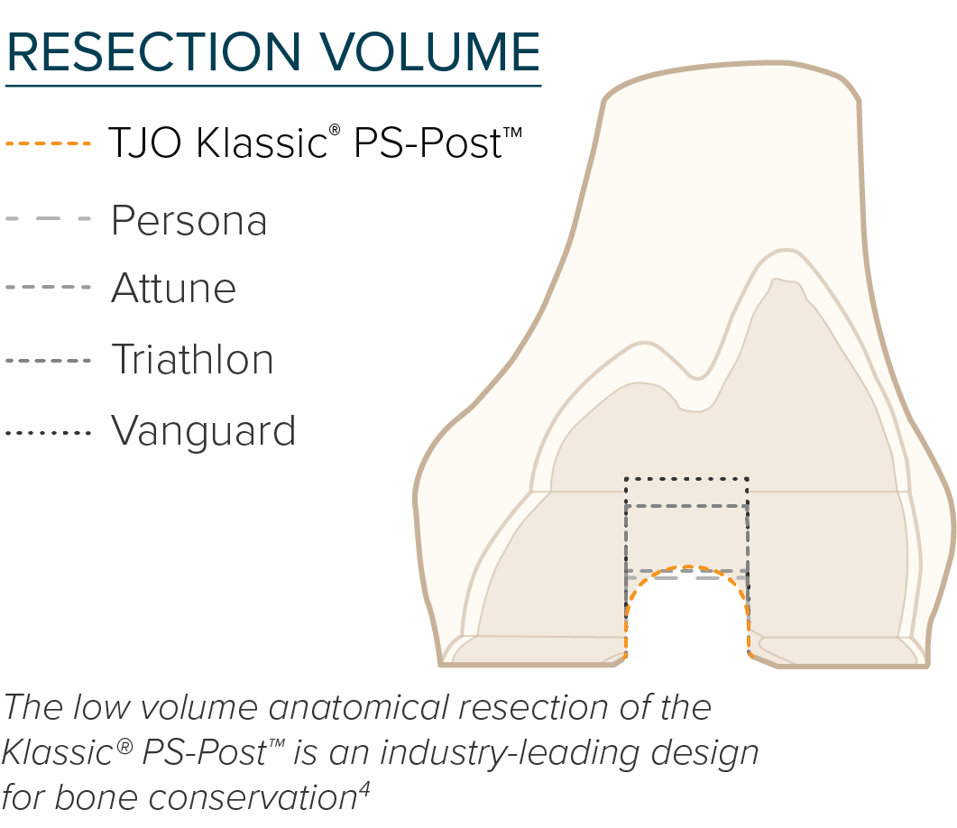 Klassic® Knee System | TJO - Total Joint Orthopedics
