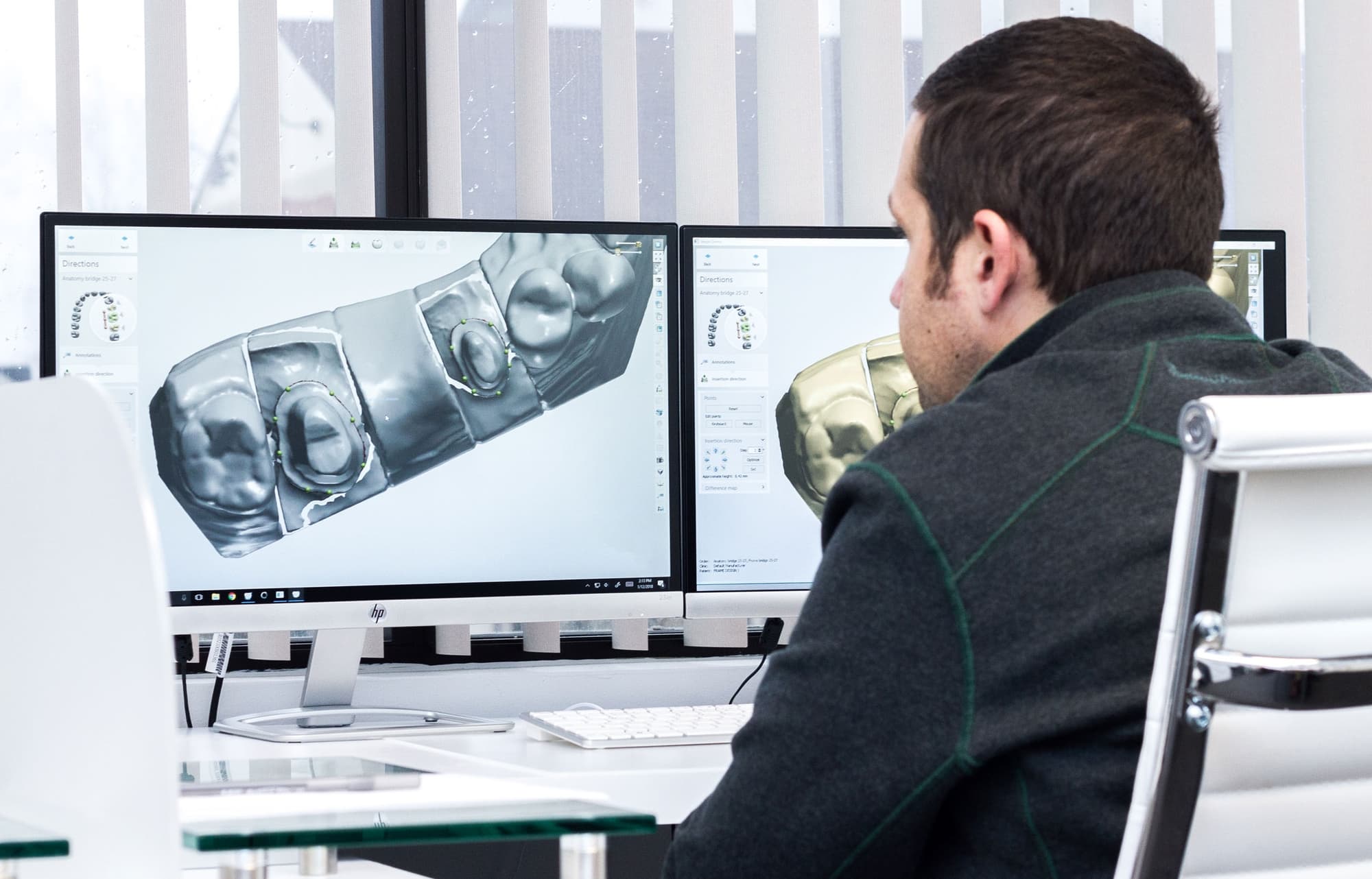 What Is Digital Smile Design And Why Is So Great?