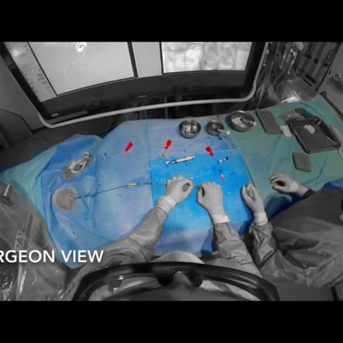 Retrograde IR Platform - Adept Medical