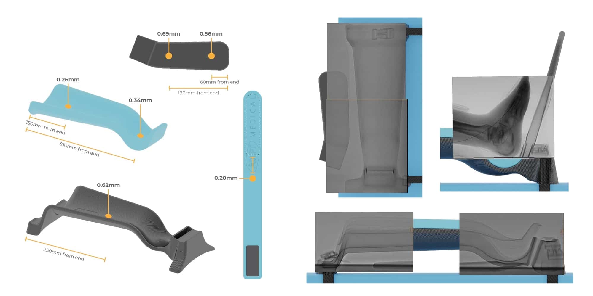 Lower Leg Support - Adept Medical