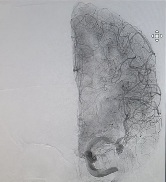 Head Immobiliser - Adept Medical