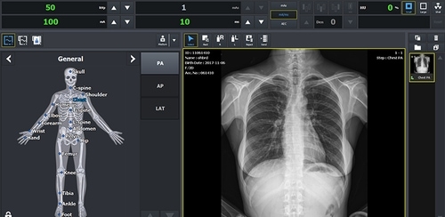 VXVUE | Digital X-Ray Company