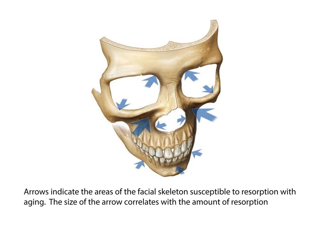 Botox Langley | Lighthouse Dental Centre | Cosmetic