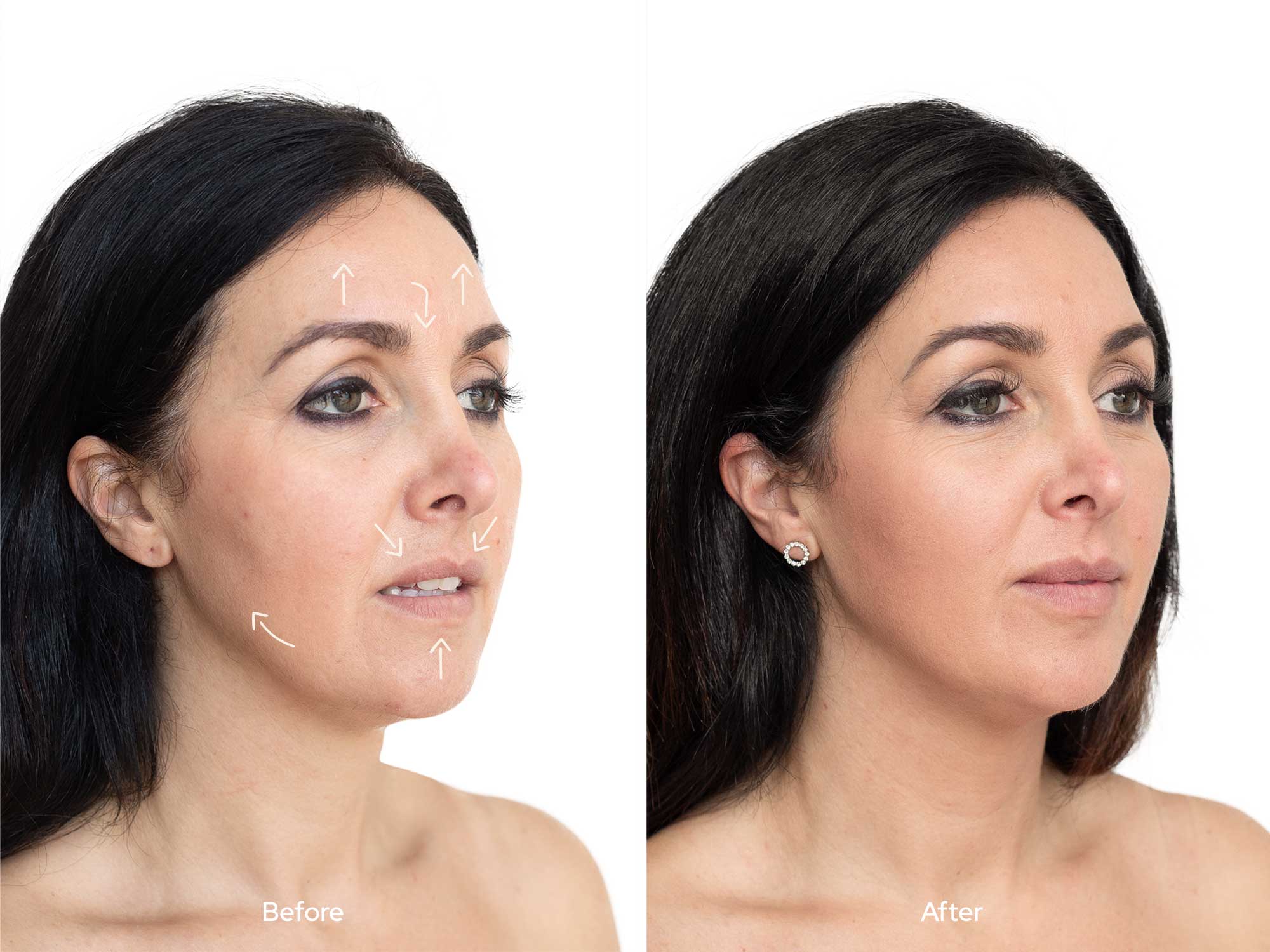 Before and After | Kay + Co